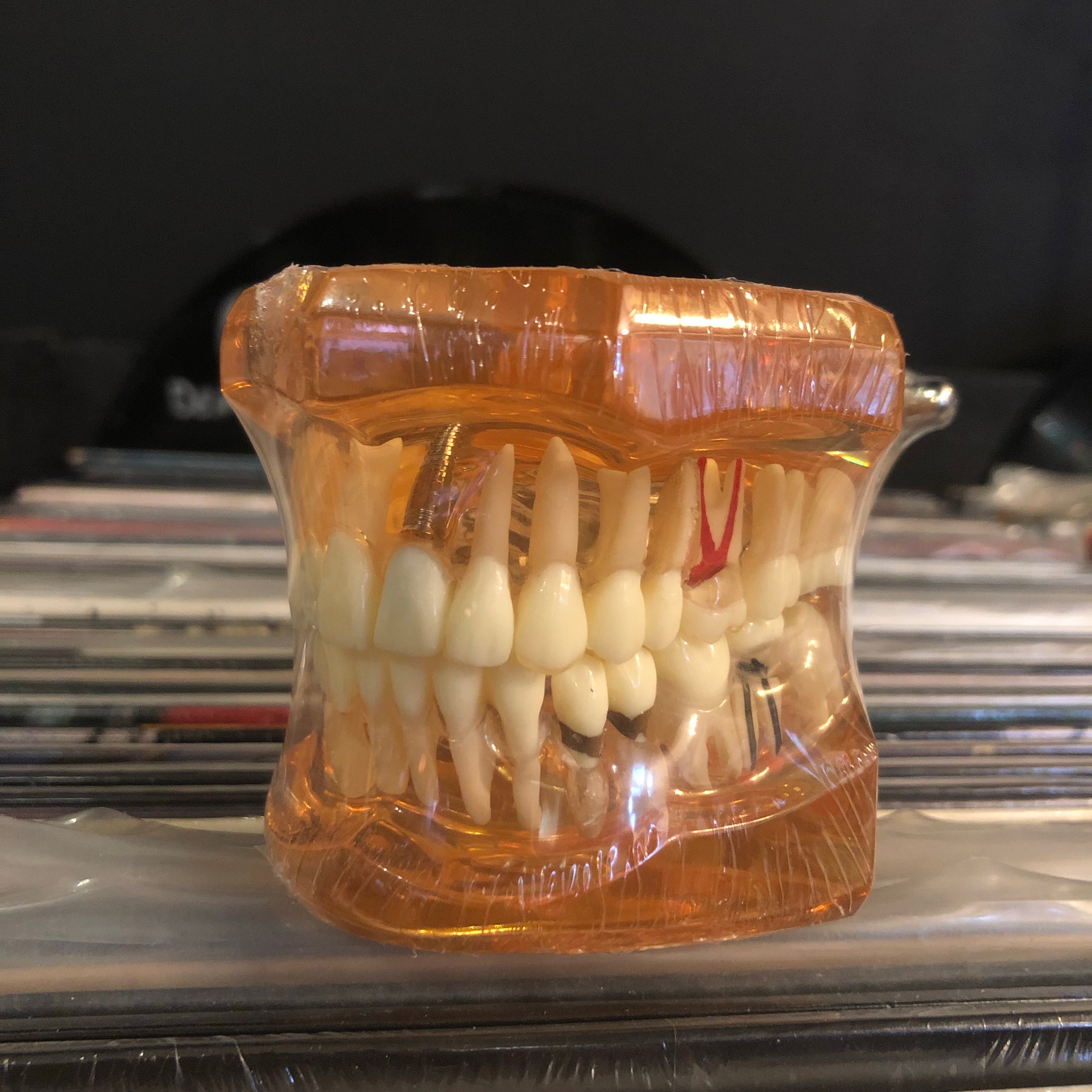 Disease Teeth Model – Hail - Records and Oddities